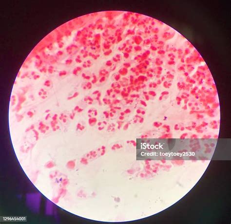 그램 얼룩의 박테리아 세포 0명에 대한 스톡 사진 및 기타 이미지 0명 건강관리와 의술 건축물 Istock