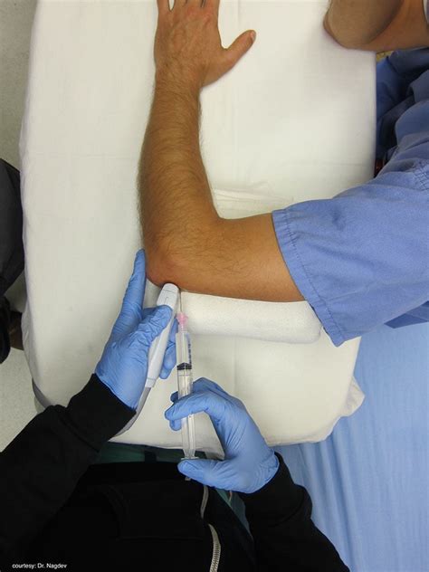 Posterior Elbow Ultrasound At Darcy Redmond Blog
