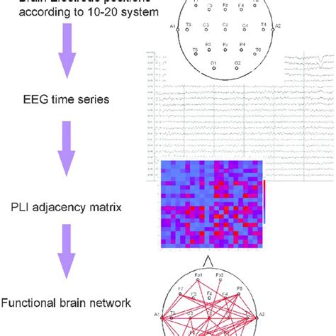 Schematic Representation Of Construction Of Graphs From EEG Time Download Scientific Diagram