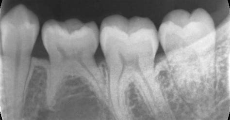 X Rays Album On Imgur