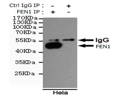 小鼠抗fen1单克隆抗体anti Fen1 Mouse Monoclonal Antibody 生命科学产品与技术服务 生工生物工程上海