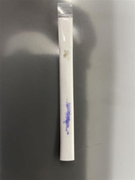 Oxidase Positive Or Negative Rbiology