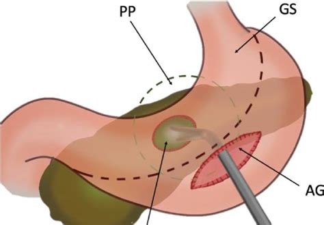 Dr Abhiman Pawar Gastroenterologist And Endoscopy Specialist In Miraj