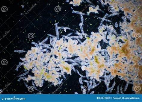 The Rotifer Rotifera Commonly Called Wheel Animals Under The