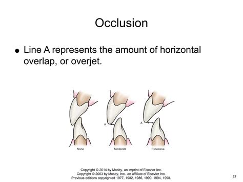 Basic Occlusion PPT