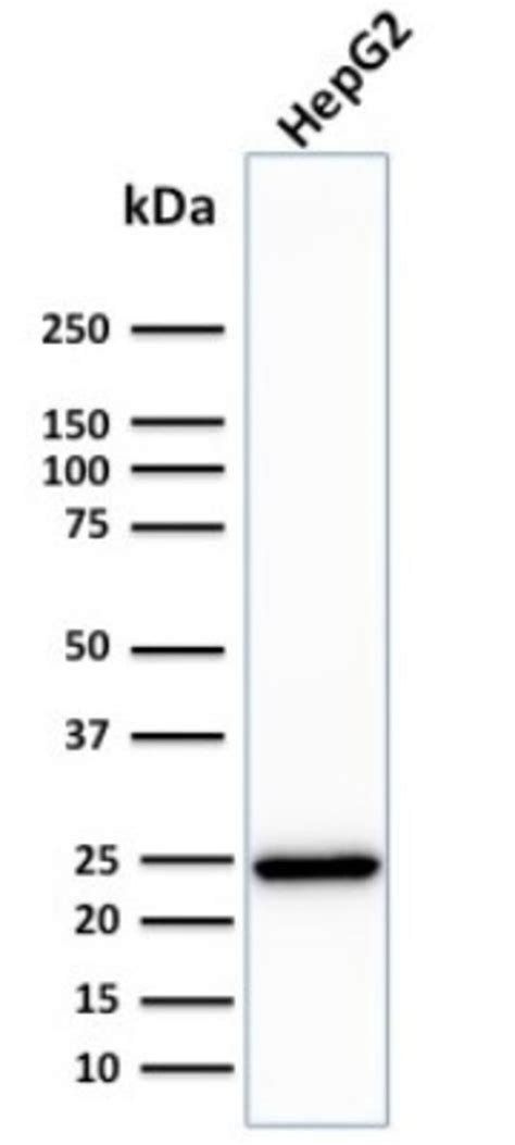 Complement Component C1qa Mouse Anti Human Clone C1qa2783 Novus