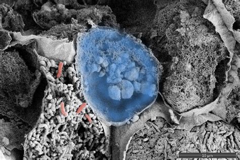 Comparison Of Cell Sizes And Volumes For A Plant G Max Root Nodule