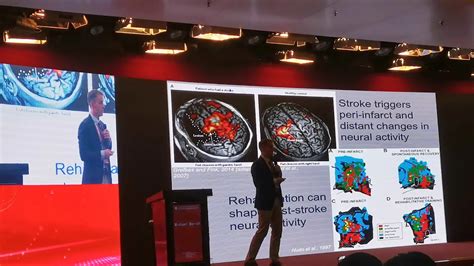 Tms And Neuroscience Tms Eeg Eeg Erp P300 N400 Ica Fft Wavelets Loreta Eeg Signal Return