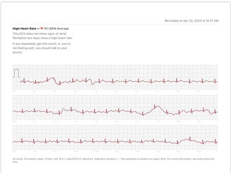 Please Help R Readmyecg