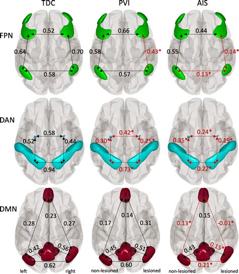 Functional Connectivity Fc Was Different Between Groups Such That The Download Scientific