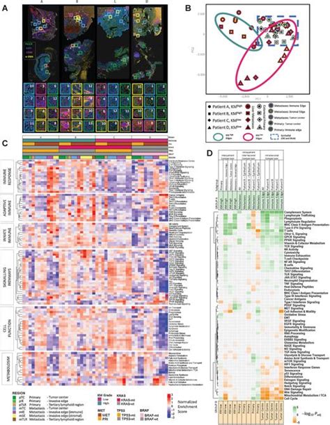 Spatially Resolved Transcriptomics Deconvolutes Prognostic Histological