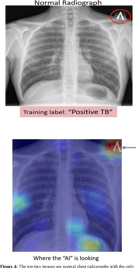 Generalization Of Artificial Intelligence Models In Medical Imaging A