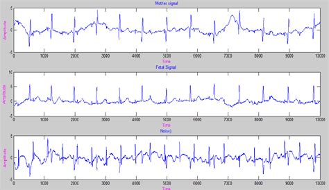 Figure 2 From Separation And Classification Of Fetal Ecg Signal By Enhanced Blind Source