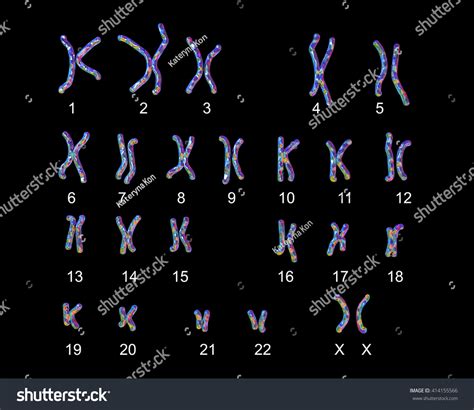 Normal Human Female Karyotype Labeled 3 D Em Ilustração Stock 414155566