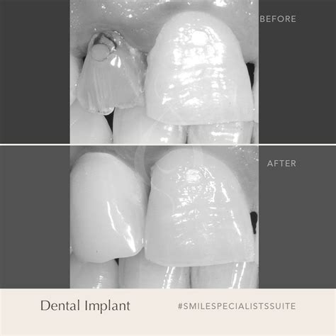 Dental Implant Smile Specialists Suite