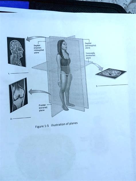 Solved Sagittal Medianc Midsagittal Plane Sagitta Parasagittal Aued Horizontal Frontal