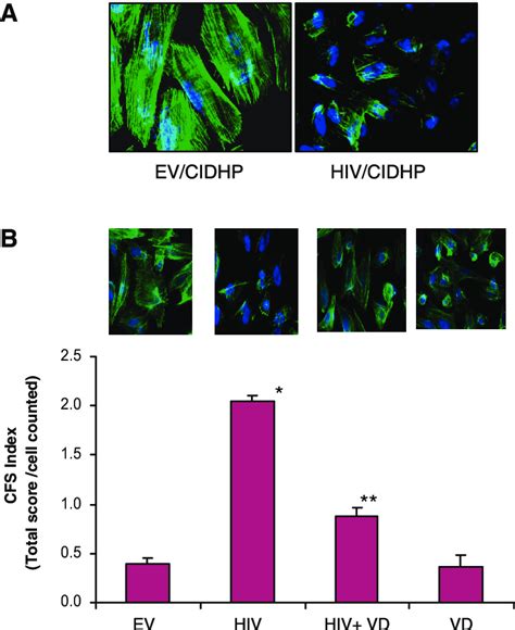 Vd Attenuates Hiv Induced Disruption Of Podocyte Actin Cytoskeleton A Download Scientific