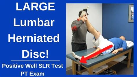 Crossed Straight Leg Raise Test