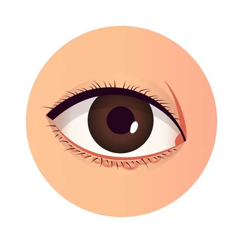 Understanding Demodex Blepharitis Symptoms And Treatment Specialty