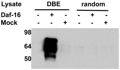 Streptavidin Bead Pull Down To Detect Dbe Binding Activity Of