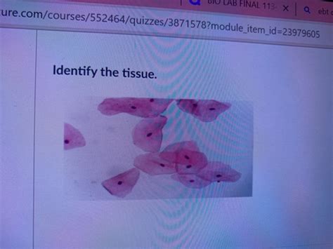 Bio 1134 Lab Final Set 6 Flashcards Quizlet