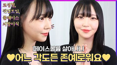 진짜 미인은 얼굴형이 입체적인 법 뒤밑트임 코성형 풀페이스 지방이식으로 페이스 볼륨 살렸더니 벌어진 일 쀼 Youtube