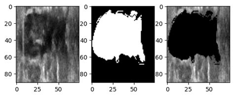 Numpy Resample Volumetric Image Data In Python Stack Overflow