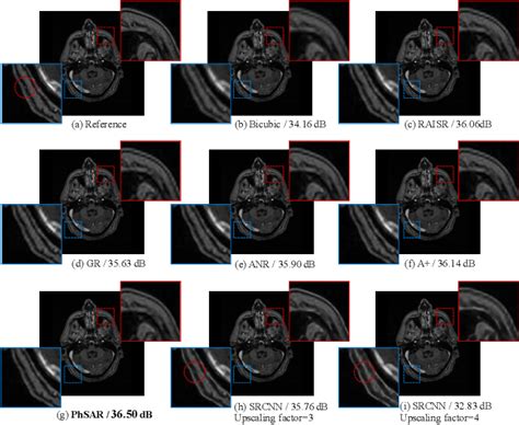Phase Stretch Transform Semantic Scholar