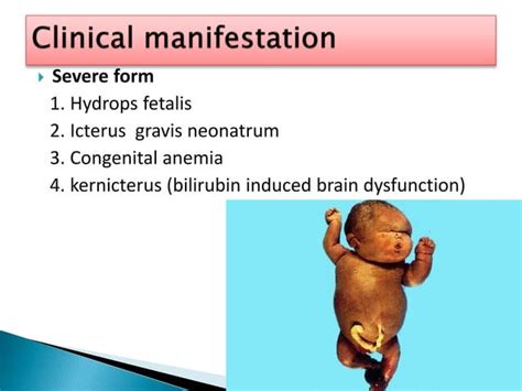 6 Rh And Abo Incompatibility Pptx Pregnancy Reproductive Health