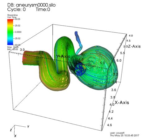Streamlines Of Loaded Unstructured Grid Data Aneurysm Fluid Dynamics