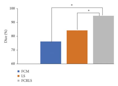 comparison of dice coefficients of different segmentation algorithms ∗