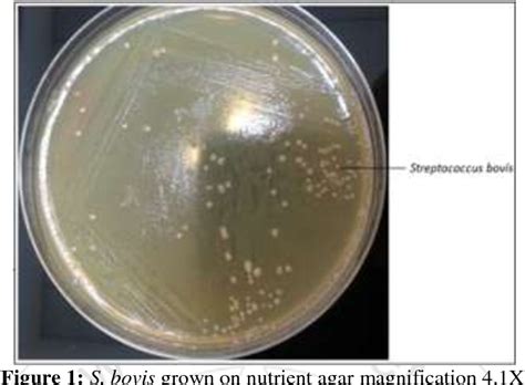 Streptococcus Bovis Identification