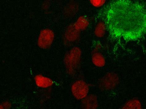 new method identifies spatial biomarkers of alzheimer s disease