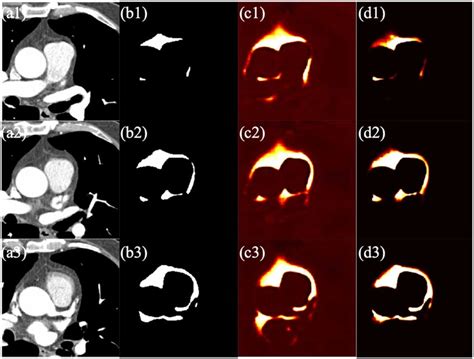 comparison of the salient map before and after ag each row shows a