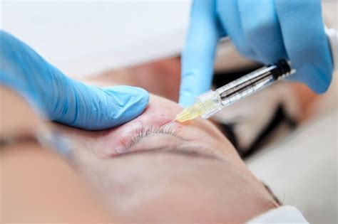 20 Microinjection Pictures