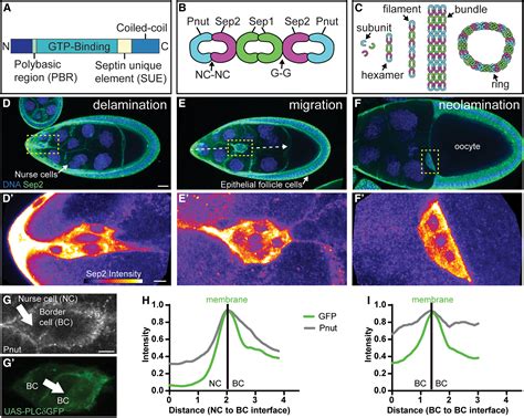 Septins Regulate Border Cell Surface Geometry Shape And Motility