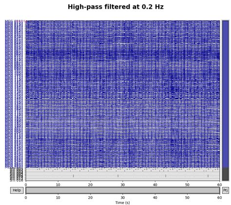 Filtering And Resampling Data — Mne 111 Documentation