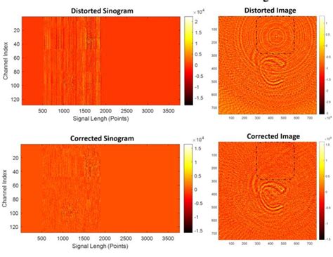 Figure 4 From Ring Artifact And Non Uniformity Correction Method For