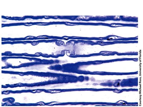 Teased Myelinated Nerve Fiber Slide