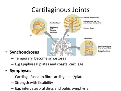 Ppt Joints Powerpoint Presentation Id 6086766