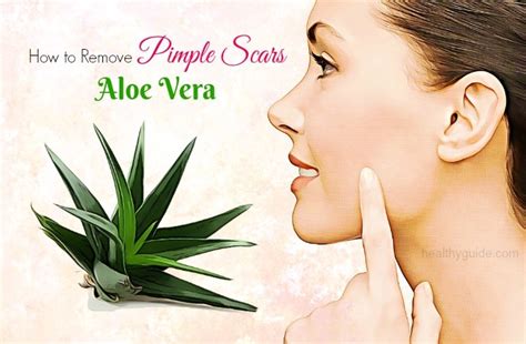 10 Tips How To Remove Pimple Scars On Nose Chest Back Legs Fast
