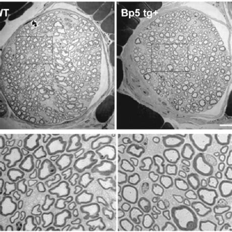 Model Of Igf 1 And Igfbp5 Function In Peripheral Nerves Of Wild Type