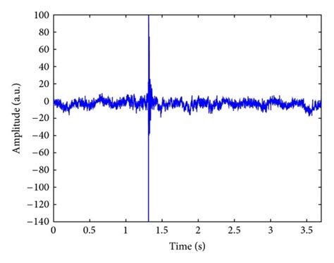 Reconstructed Vag Signals With The Wavelet Matching Pursuit Atoms With Download Scientific