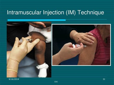 Ppt Massachusetts Department Of Public Health Training Module