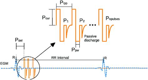 Typical Vagus Nerve Stimulation Pattern Solid Line Synchronized With Download Scientific