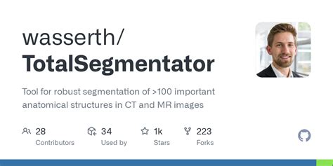 Problem Running Totalsegmentator In Slicer 5 4 Support 3d Slicer Community