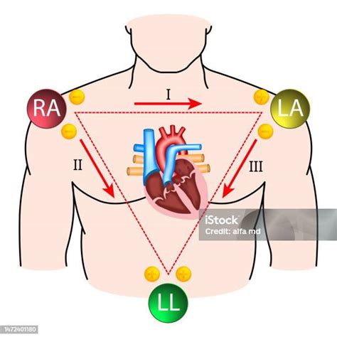 Standard Limb Leads Ecg Einthoven Triangle Electrocardiogram Stock