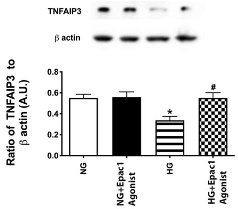 Tnfaip3 Is Anti Inflammatory In The Retinal Vasculature Pmc