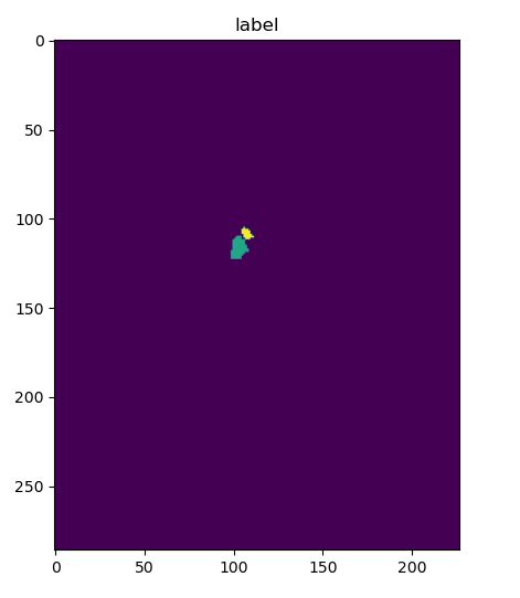 Runtimeerror Cuda Error Device Side Assert Triggered Pycad Your