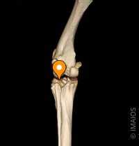 Lateral Condyle Vet Anatomy Imaios